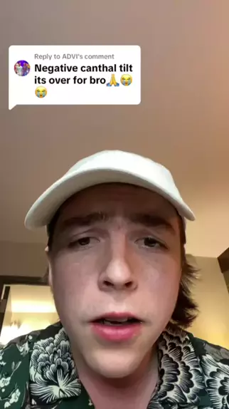 negative canthal tilt it's over for bro | Discover